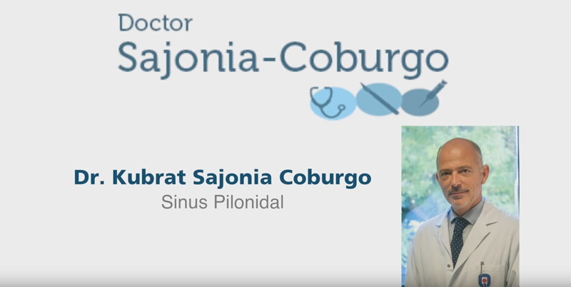 ¿Qué es un Sinus pilonidal y a quienes afecta?Doctor Sajonia-Coburgo